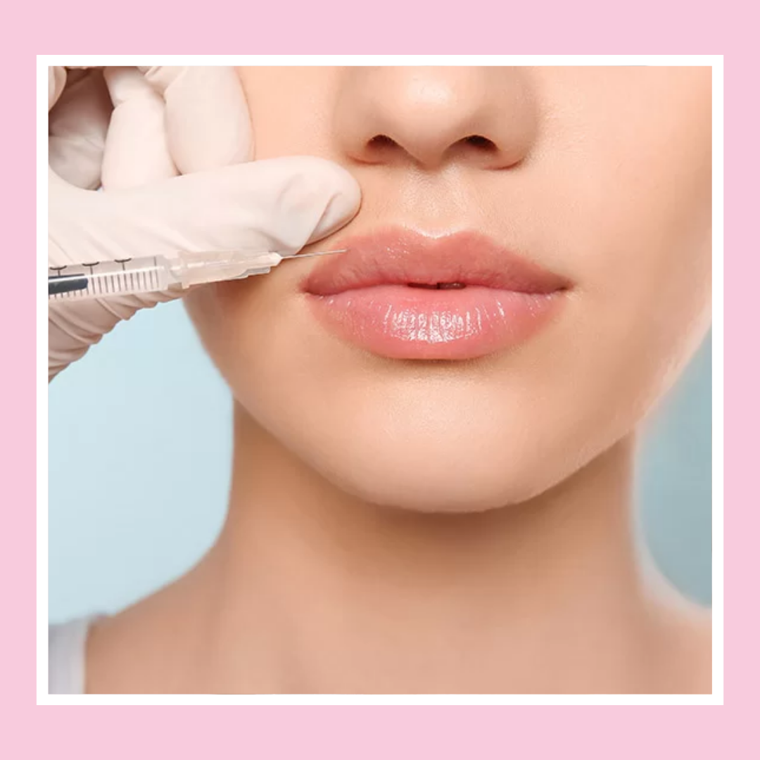 Lip Fillers London | Enhance Your pout with Dermal Fillers