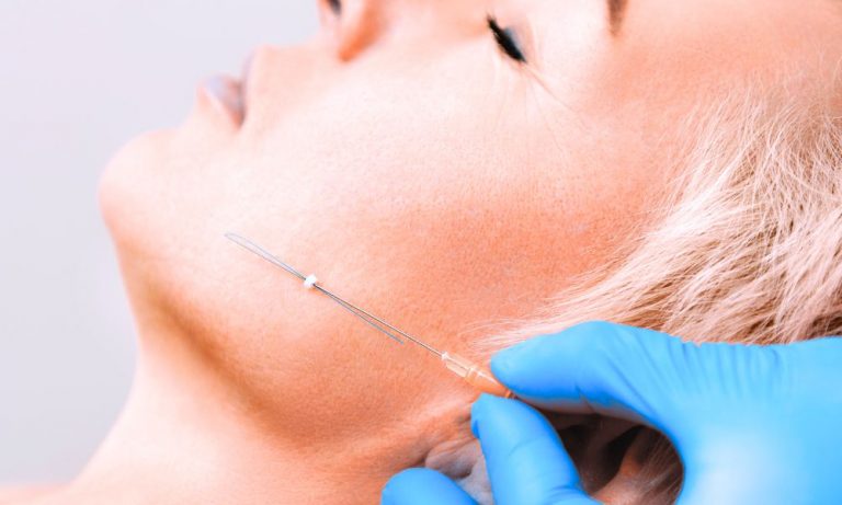 Definisse Threads at Dermal Health - Discover the Difference