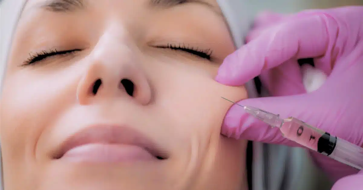 Cheek Fillers London | Sculpted Cheekbones with Dermal Fillers | Non ...